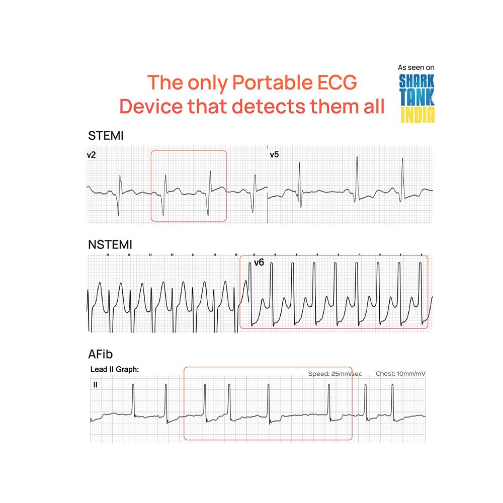 Spandan Portable ECG Device | 30 Minutes 24/7 Delivery