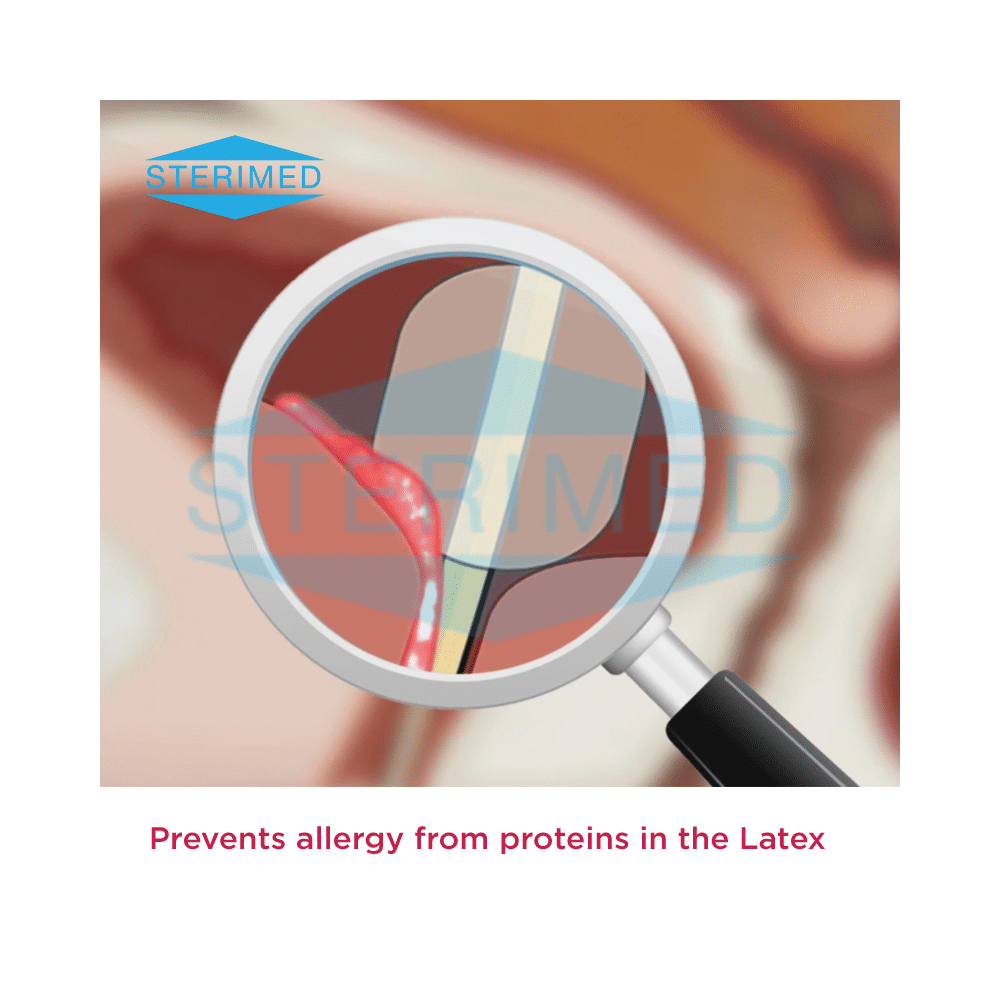 Sterimed Foley Balloon Catheter Regular 2 Way 6 FR | 30 Minutes 24/7 ...